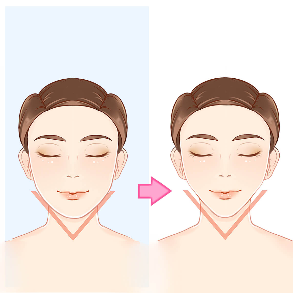 Can I Get A V Shape Face Without Surgery Answered By Beverly Wilshire Medical Centre Erufu Care