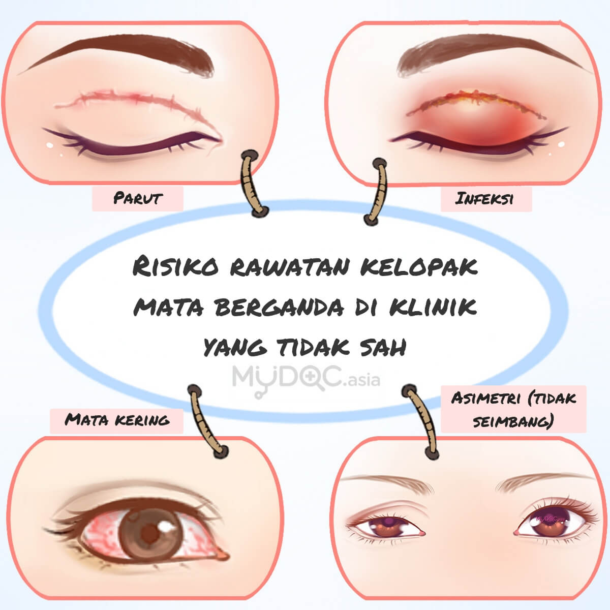 Kelopak Mata Berganda Tanpa Pembedahan? | Erufu Care