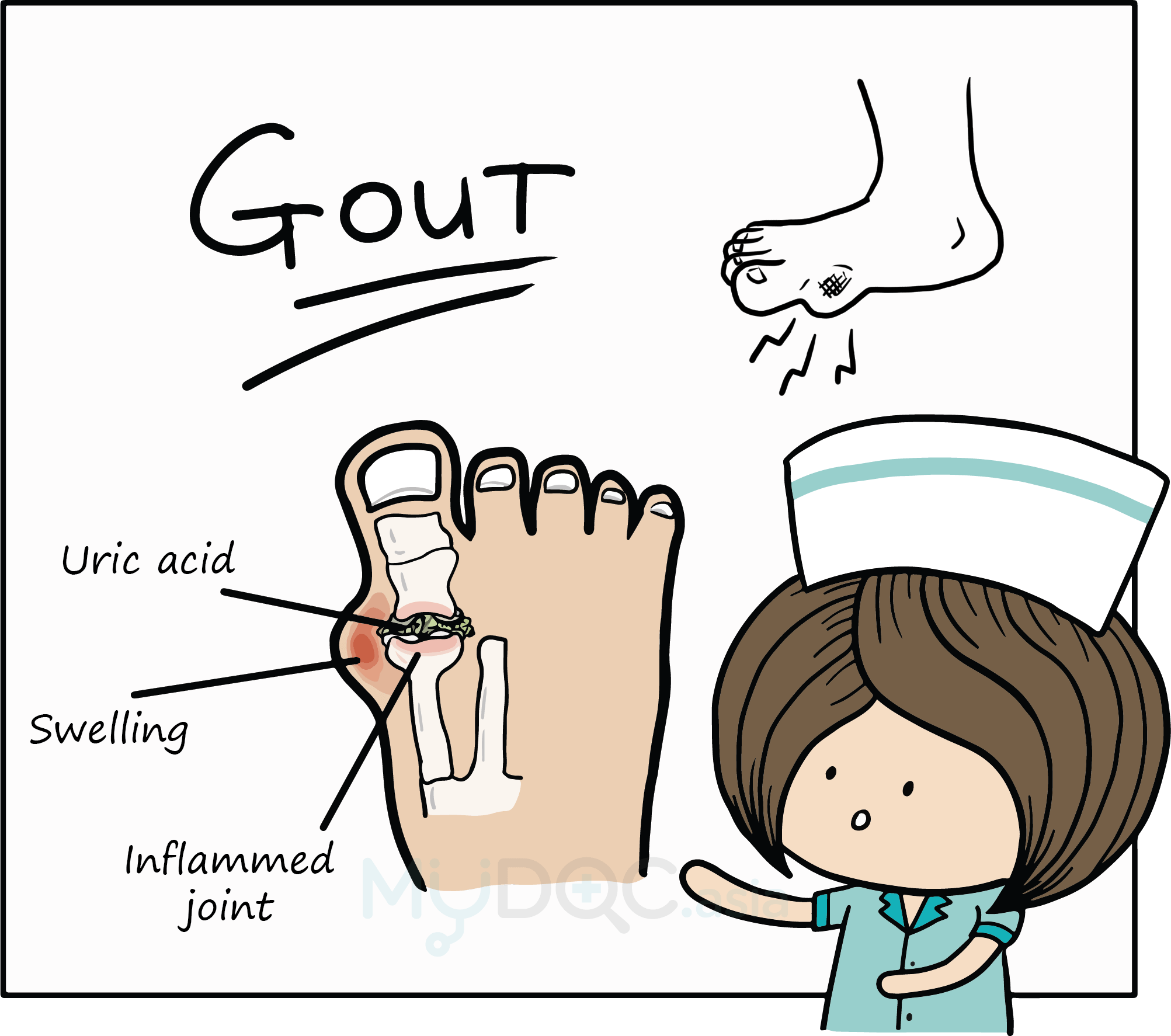 【问与答】健康的生活方式 让你免受痛风的袭击 | Erufu Care