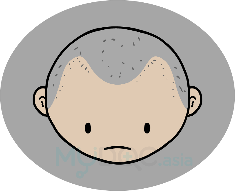 Will I be Bald like My Parents? | Erufu Care