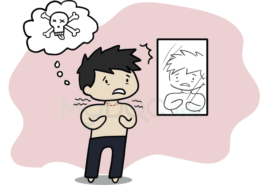 Penyakit Kayap – Soalan Lazim dengan Jawapan Juliet | Erufu Care