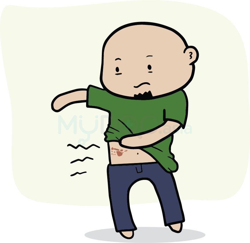 Penyakit Kayap – Soalan Lazim dengan Jawapan Juliet | Erufu Care