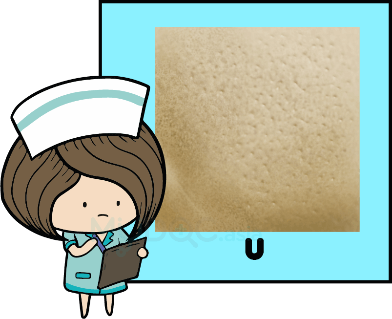 3 Types of Large Pores - Which is Yours? | Erufu Care