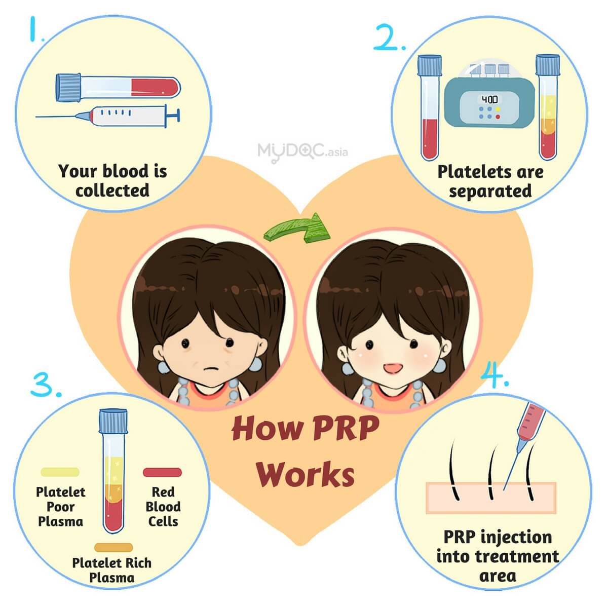 PRP Injection for Face: Anti-Aging Solution Explained by The Doctor ...