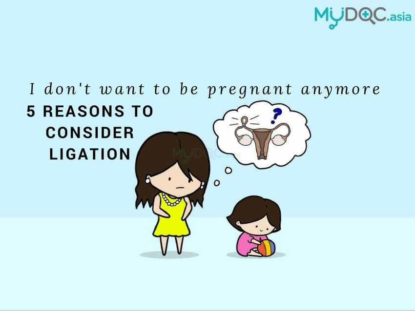 5 Reasons Why You May Want to Consider Ligation for Contraception ...