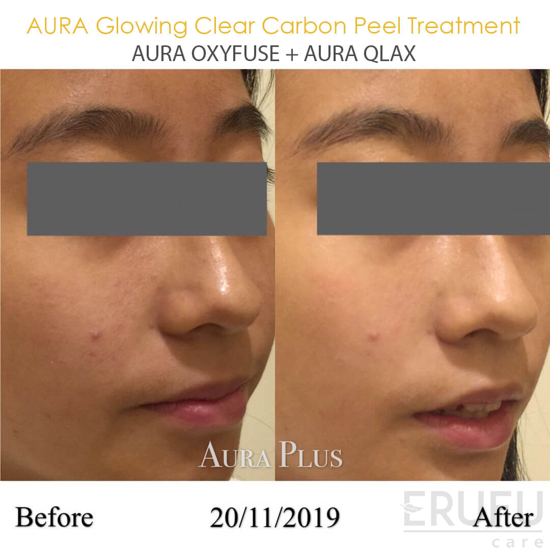 Aura Plus - Medical Aesthetics & Anti-Aging - Price & Reviews | Erufu Care