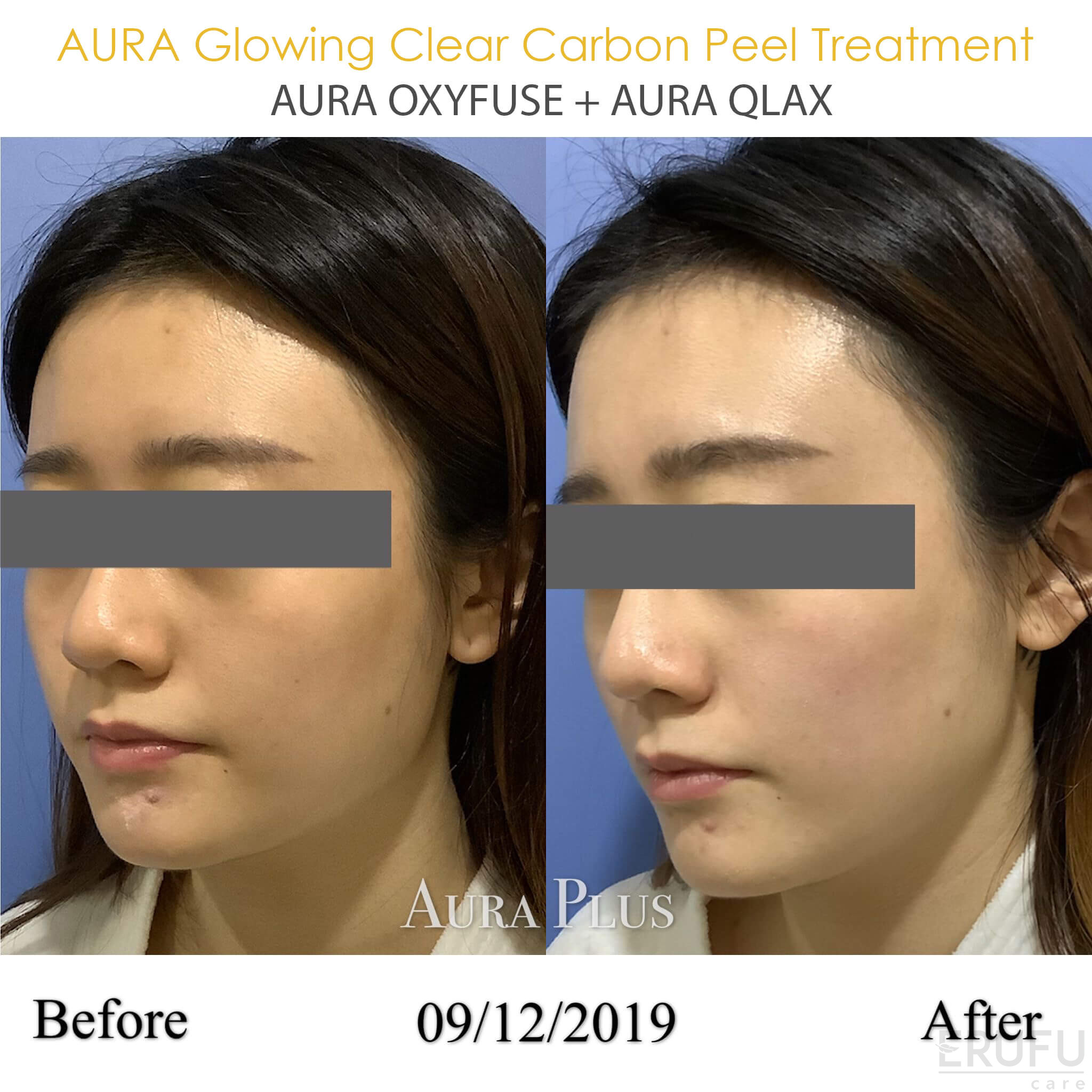 Aura Plus - Medical Aesthetics & Anti-Aging - Price & Reviews | Erufu Care