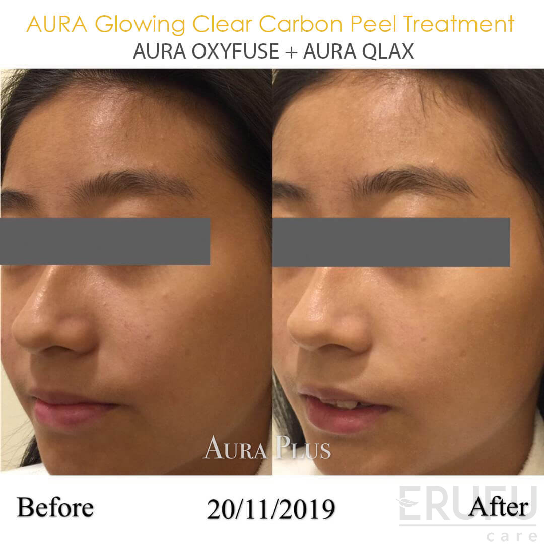 Aura Plus - Medical Aesthetics & Anti-Aging - Price & Reviews | Erufu Care