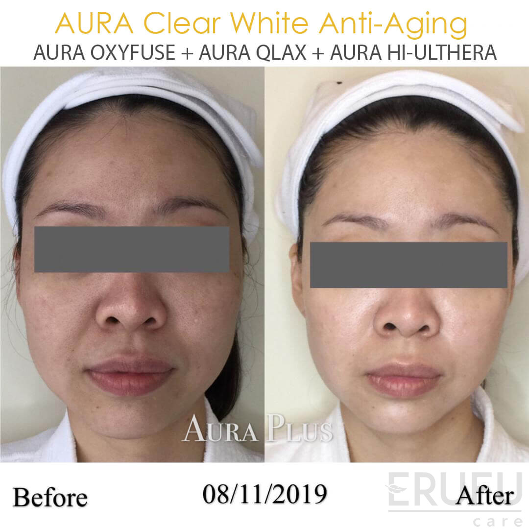 Aura Plus - Medical Aesthetics & Anti-Aging - Price & Reviews | Erufu Care