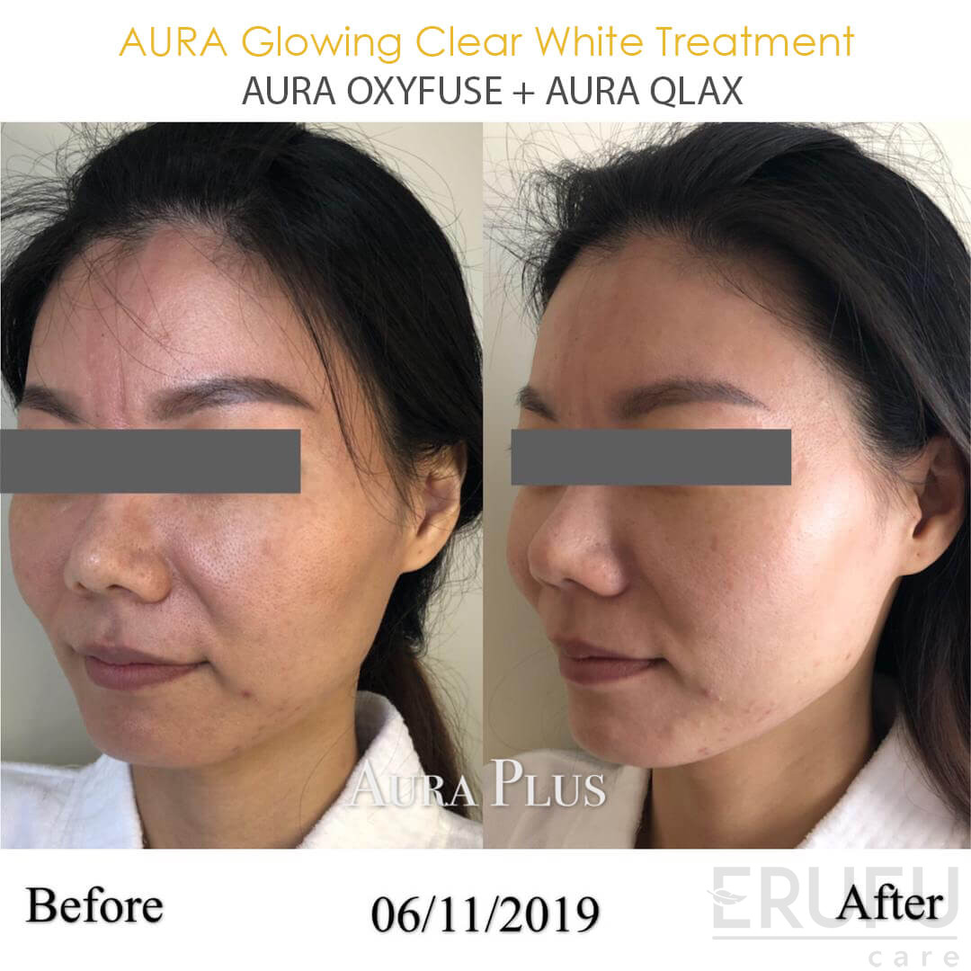 Aura Plus - Medical Aesthetics & Anti-Aging - Price & Reviews | Erufu Care