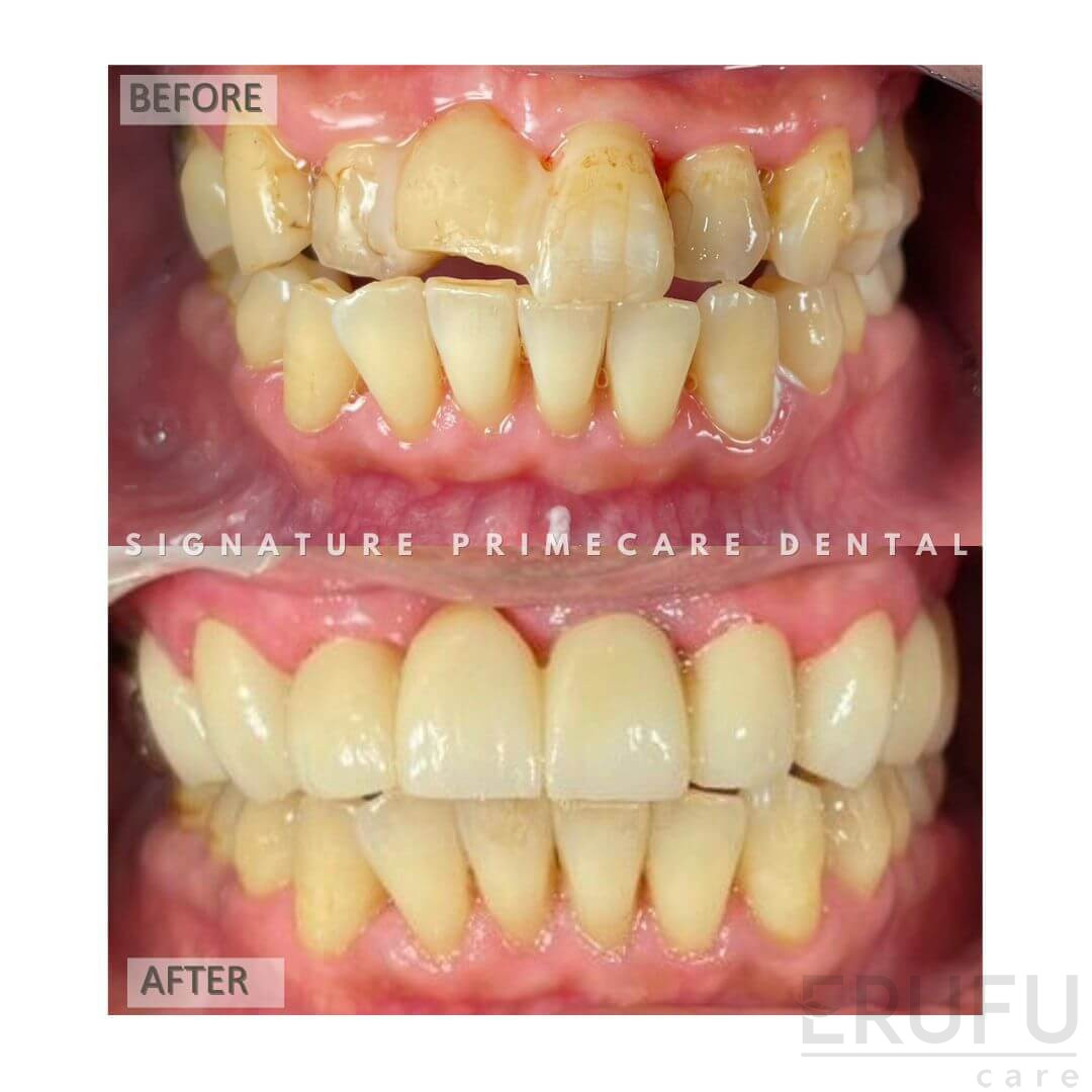 52 Best Tooth Extractions in Malaysia - Price Guide & Reviews