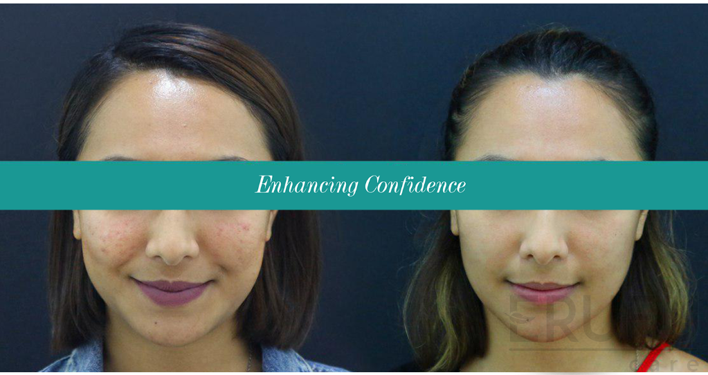 13 Best Dermatologist, Skin and Specialist Clinics in Petaling Jaya ...