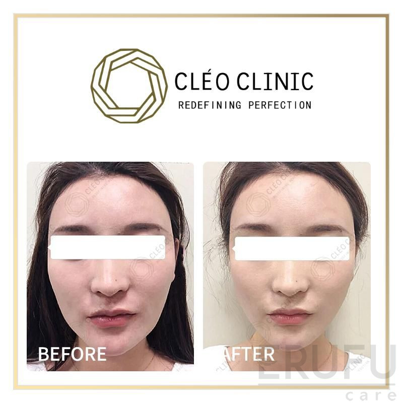 44 Best Aesthetic Clinics in Kuala Lumpur - Price Guide & Reviews